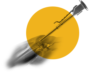 Profemur® Preserve hip stem | MicroPort Orthopedics