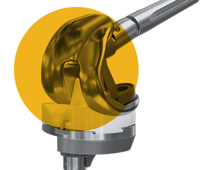 Advance® Medial-Pivot Knee System | MicroPort Orthopedics