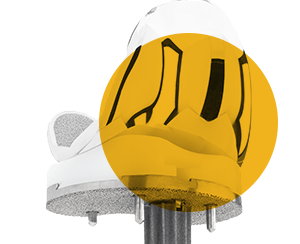 Advance® Medial-Pivot Knee System | MicroPort Orthopedics