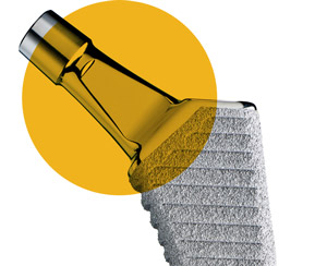 Profemur® L hip stem | MicroPort Orthopedics