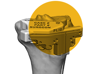 Prophecy® Navigation Guides | MicroPort Orthopedics