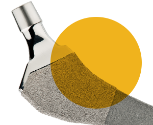 Profemur® R revision hip stem | MicroPort Orthopedics