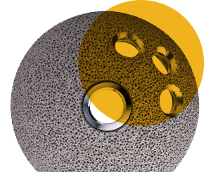 BIOLOX®delta Ceramic Hip Heads | MicroPort Orthopedics