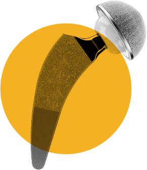 Achieve Full Function, Faster | MicroPort Orthopedics